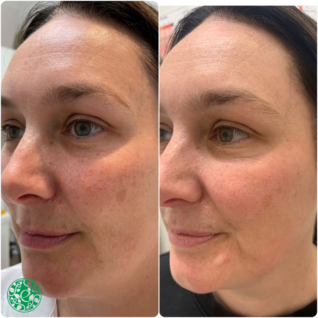 Current Promotions at Elements - Element Skin Aesthetics